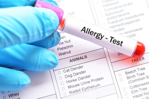 Allergy Test in Malaysia: Types, Benefits & Where to Get Tested Near ...