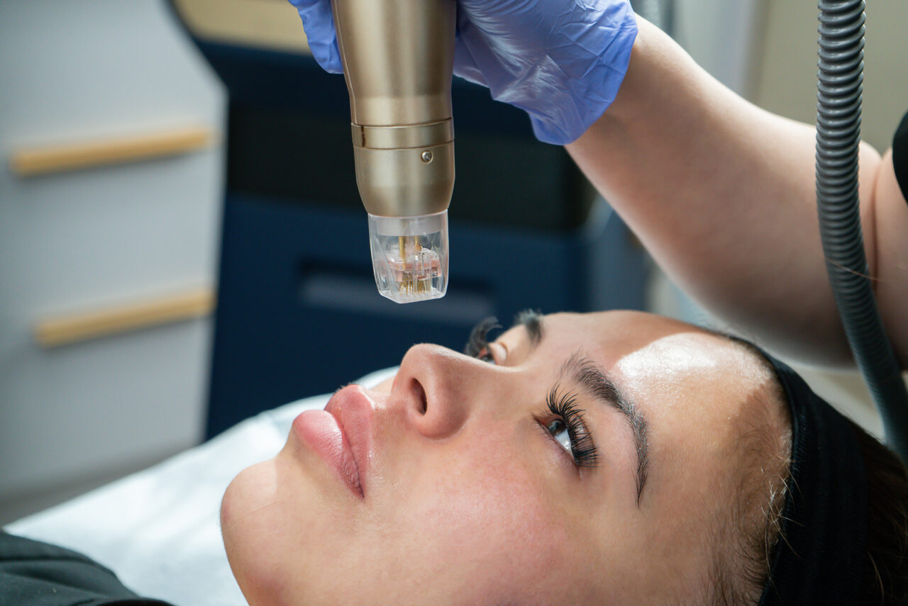Picolaser Combo Treatments: The Secret Skincare Weapon You Need Now ...