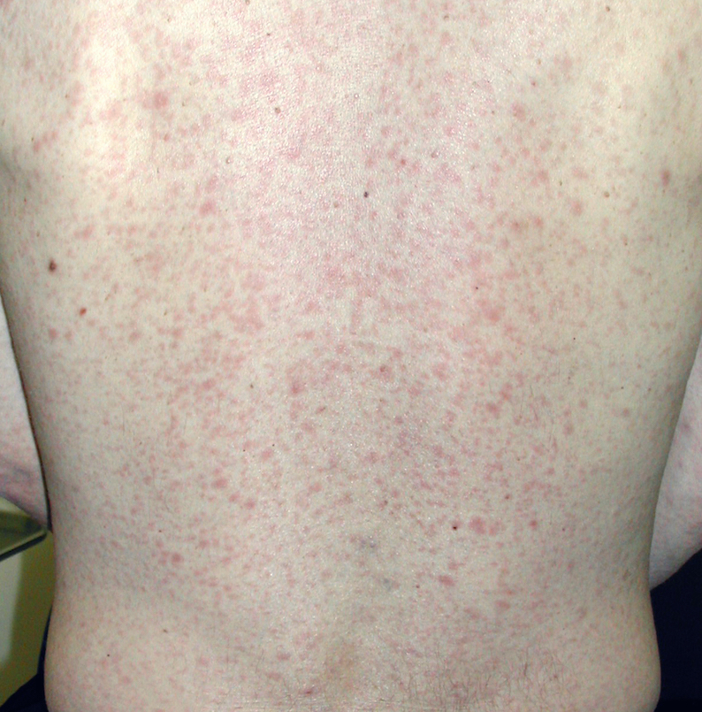 Best STD Testing & Screening in Petaling Jaya - NextMed Clinic