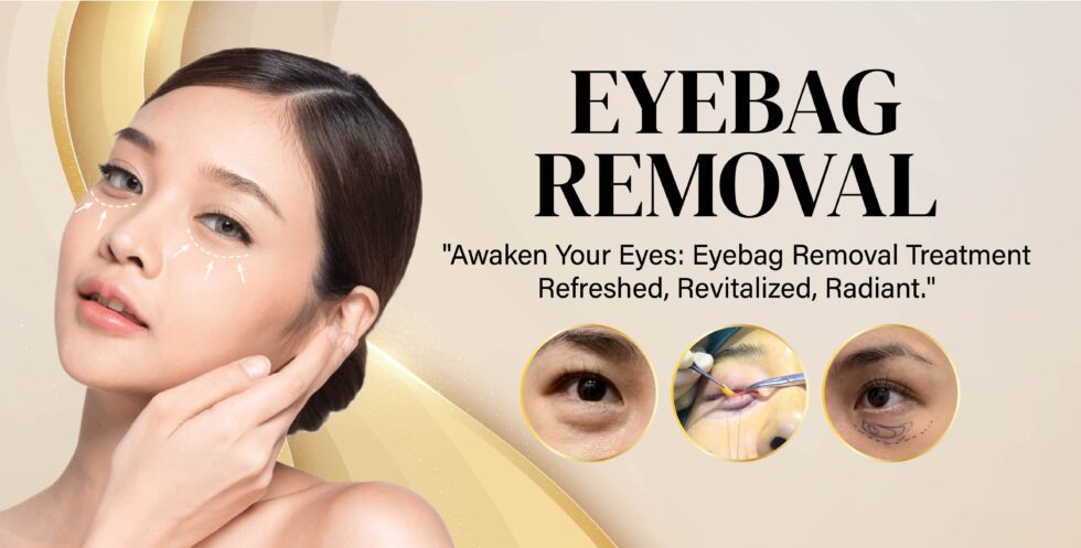 Transform Your Look with Effective Eyebag Removal Treatment in Malaysia ...