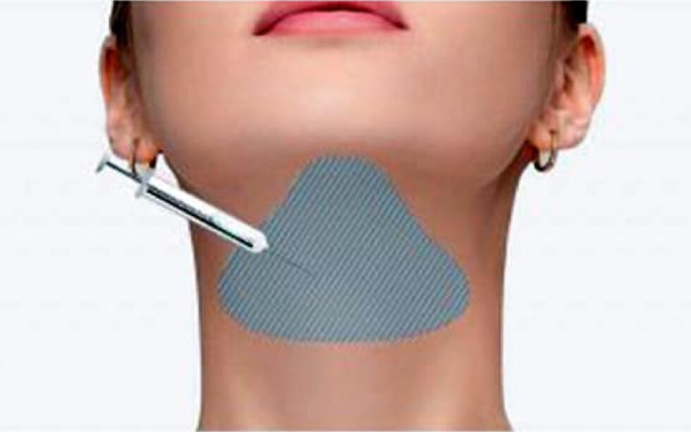 Sculpt Your Body: Exploring Mesolipo Fat Melting Injection for Targeted ...