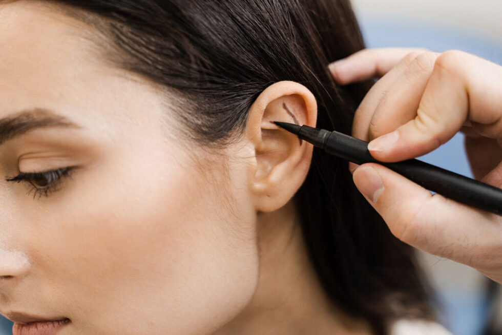 Suture Otoplasty vs Traditional Otoplasty: A Comparative Guide ...
