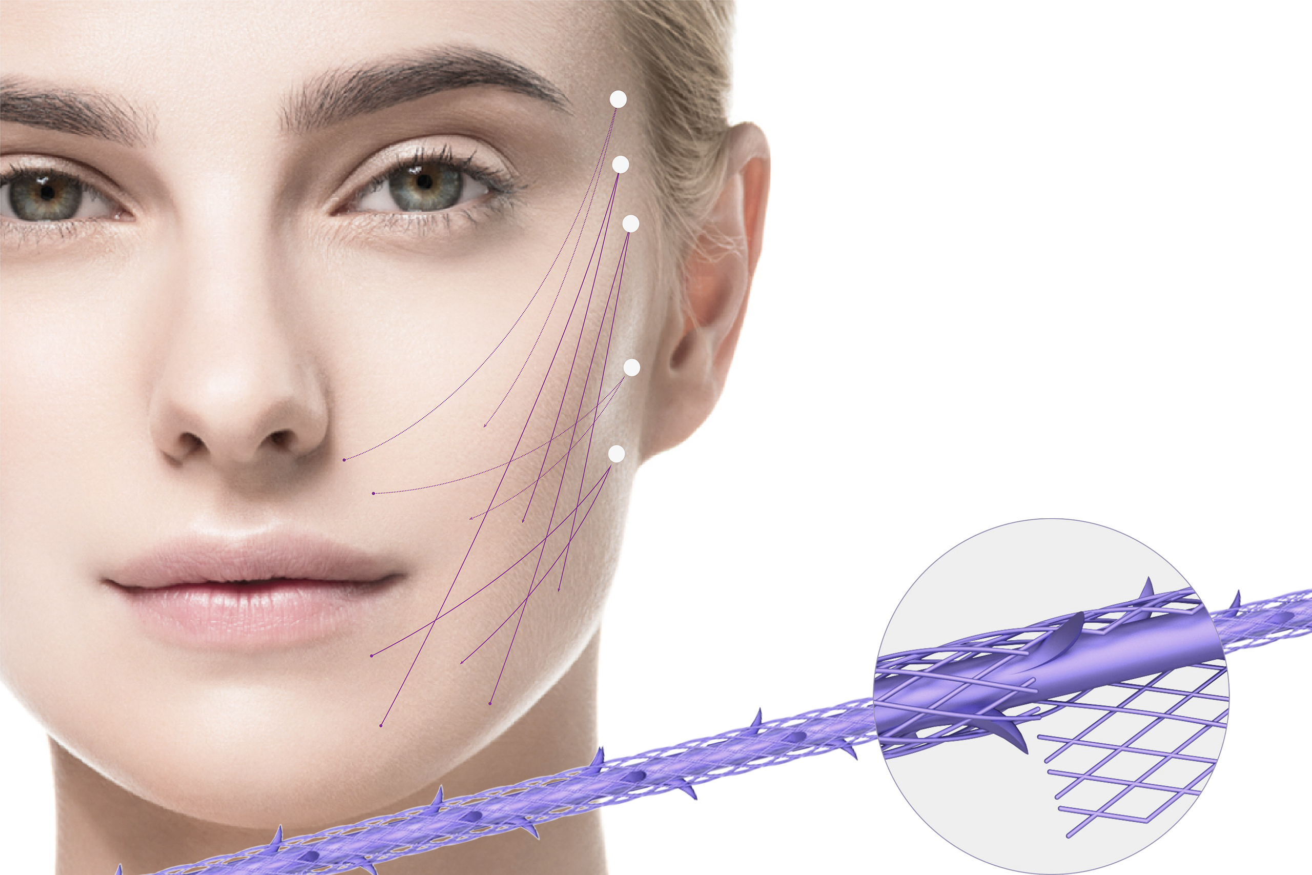 Benefits of Tesslift in Malaysia – Natural Lift Without Surgery ...