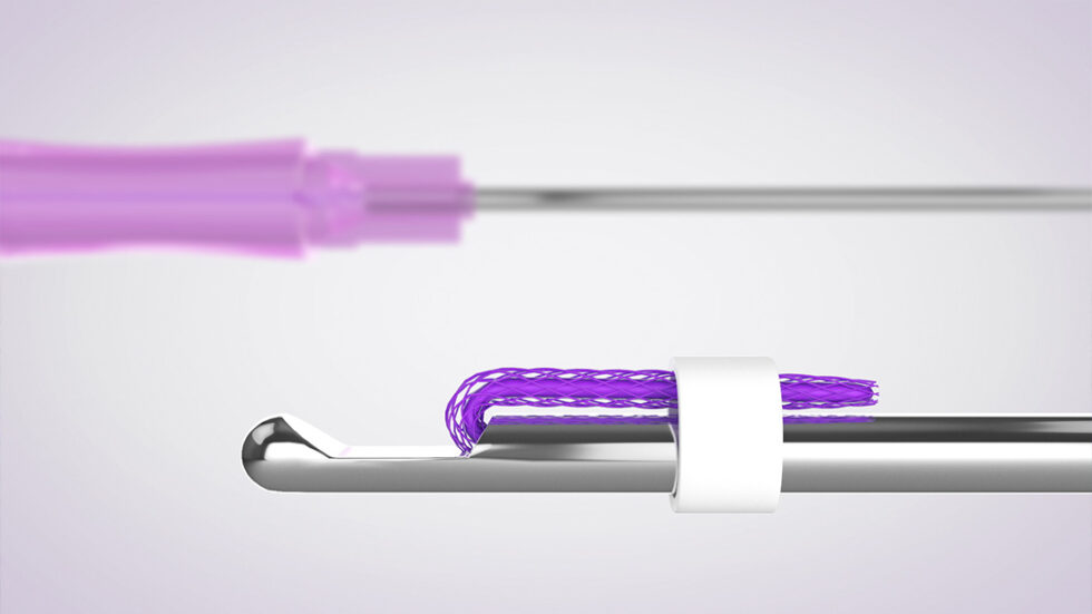 Tesslift vs Normal Thread Lift – Which Is Better in Malaysia? - NextMed ...
